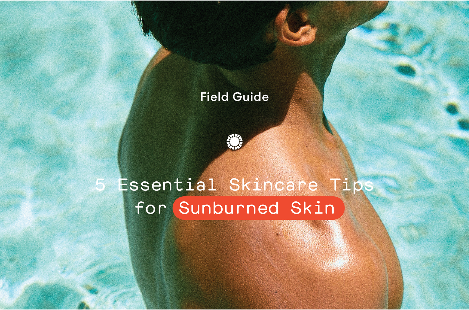 Field Guide: 5 Essential Tips for Treating Sunburned Skin – Koa